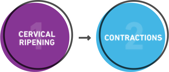 Planning for Labor Induction with CERVIDIL® (dinoprostone)